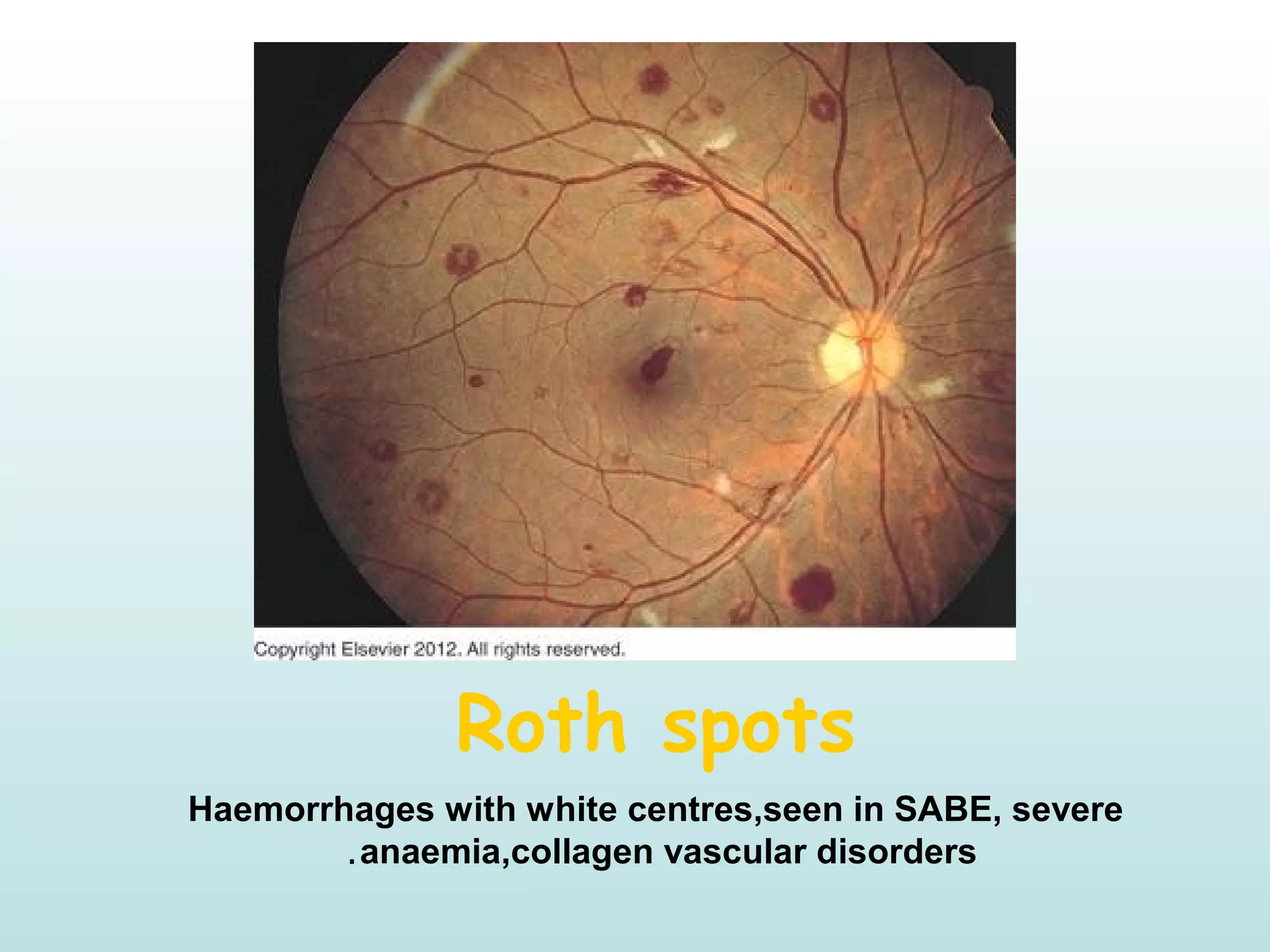 Rings Dots Lines Spots Ppt