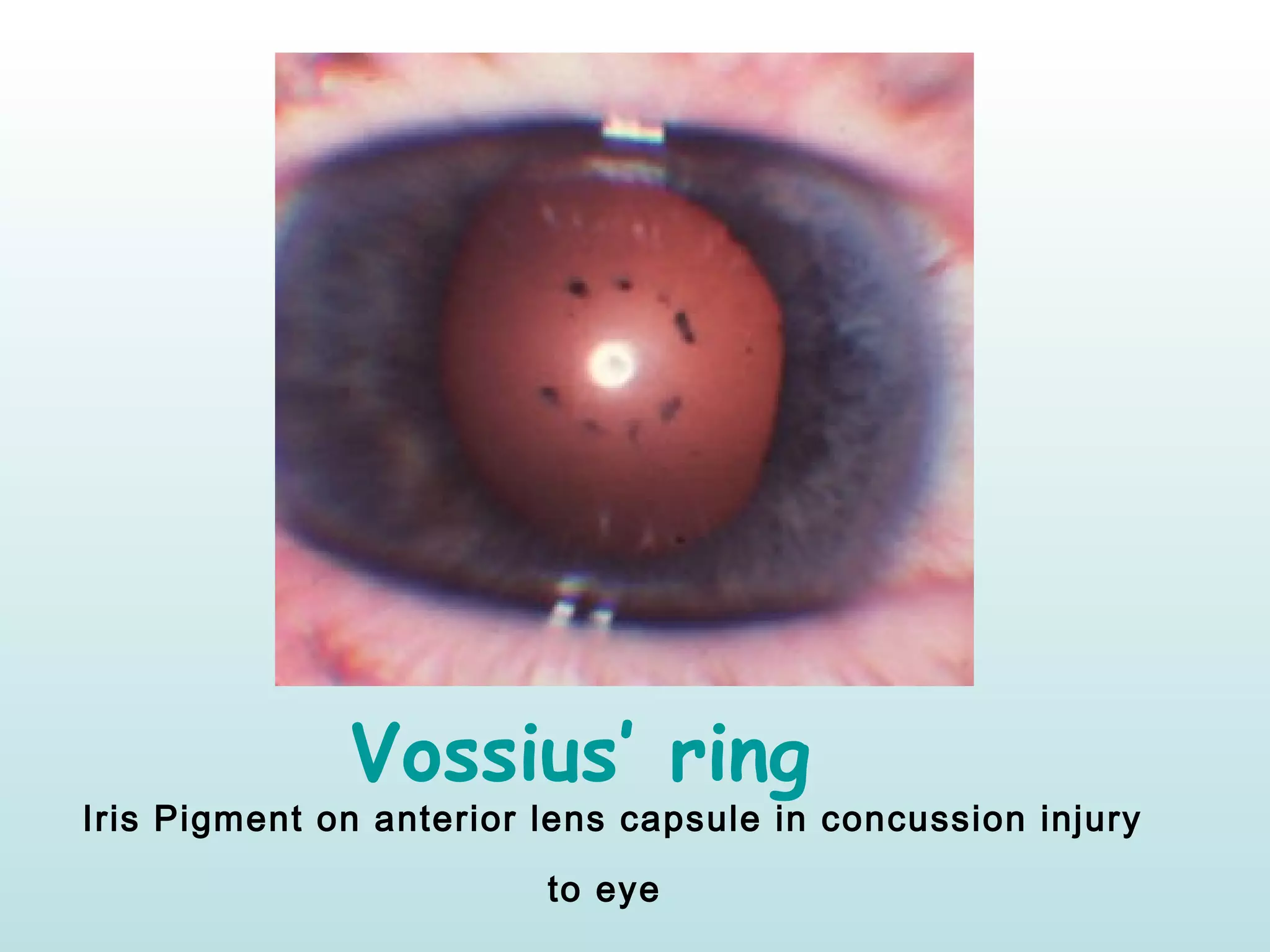 Rings Dots Lines Spots Ppt