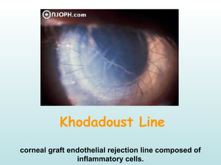 Rings, Dots, Lines & Spots | PPT