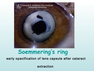 Rings, Dots, Lines & Spots | PPT