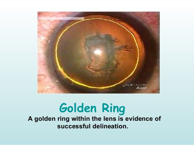 Rings, Dots, Lines & Spots