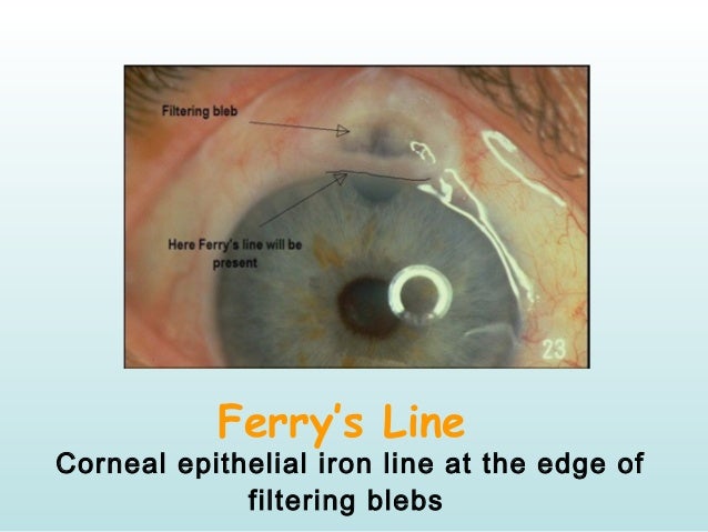 Rings, Dots, Lines & Spots