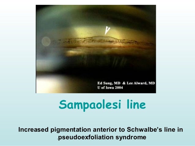 Rings, Dots, Lines & Spots