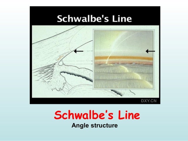 Rings, Dots, Lines & Spots