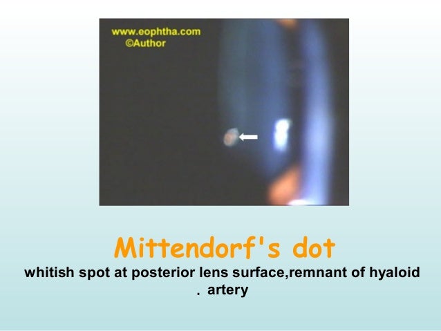 Rings, Dots, Lines & Spots