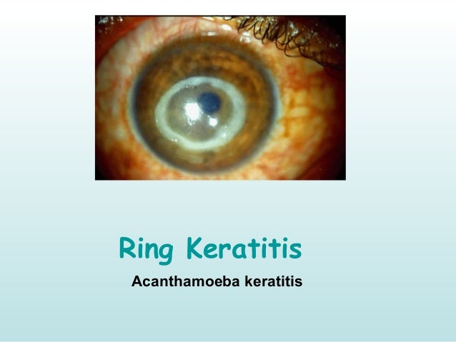 Rings, Dots, Lines & Spots