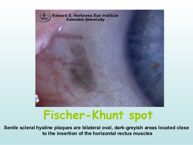 Rings, Dots, Lines & Spots