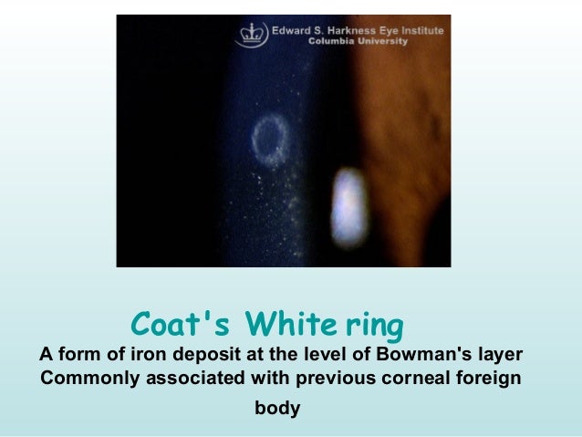 Rings, Dots, Lines & Spots