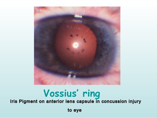 Rings, Dots, Lines & Spots