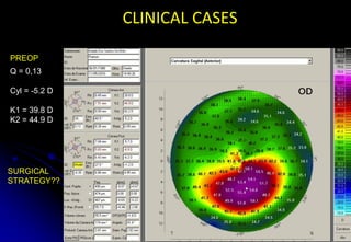 Rings chosen based on asphericity | PDF