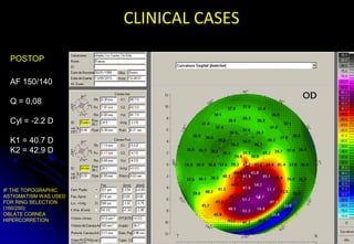 Rings chosen based on asphericity | PDF