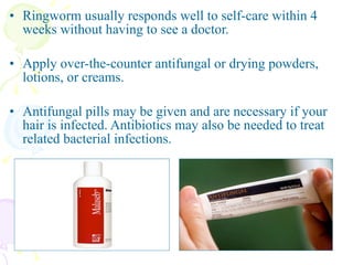 Ringworm | PPT