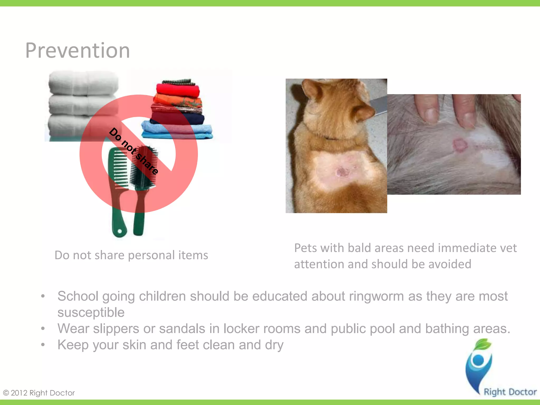 Ringworm | PPTX