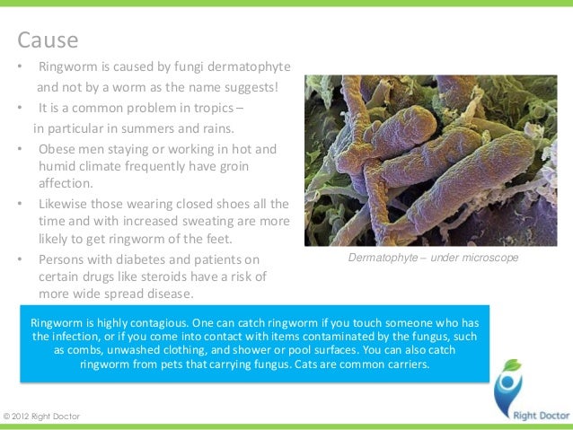 Ringworm Stages The Different Stages Of Ringworm Infection
