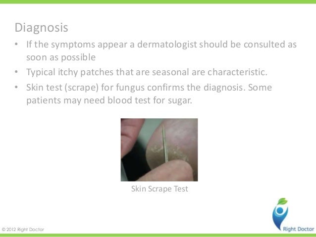 Ringworm Pictures How To Identify Ringworm On Your Body