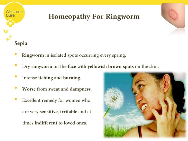 Treating Ringworm Infection, Achieving Flawless skin with Homeopathy! | PPT