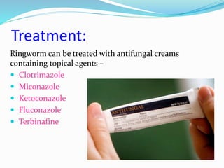 Treatment Ringworm Symptoms
