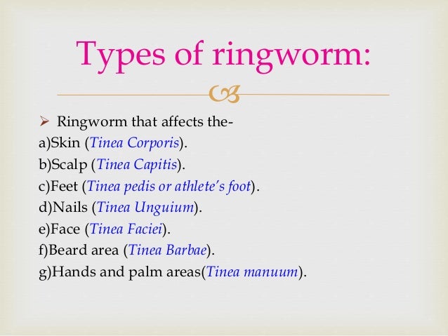 Ringworm