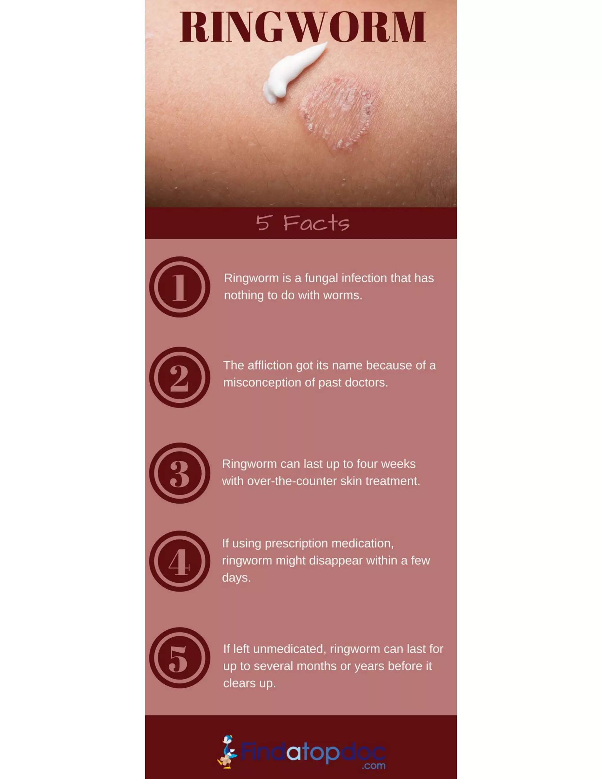 Facts About Ringworm | PDF