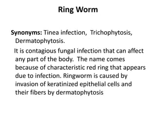 Ringworm | PPTX