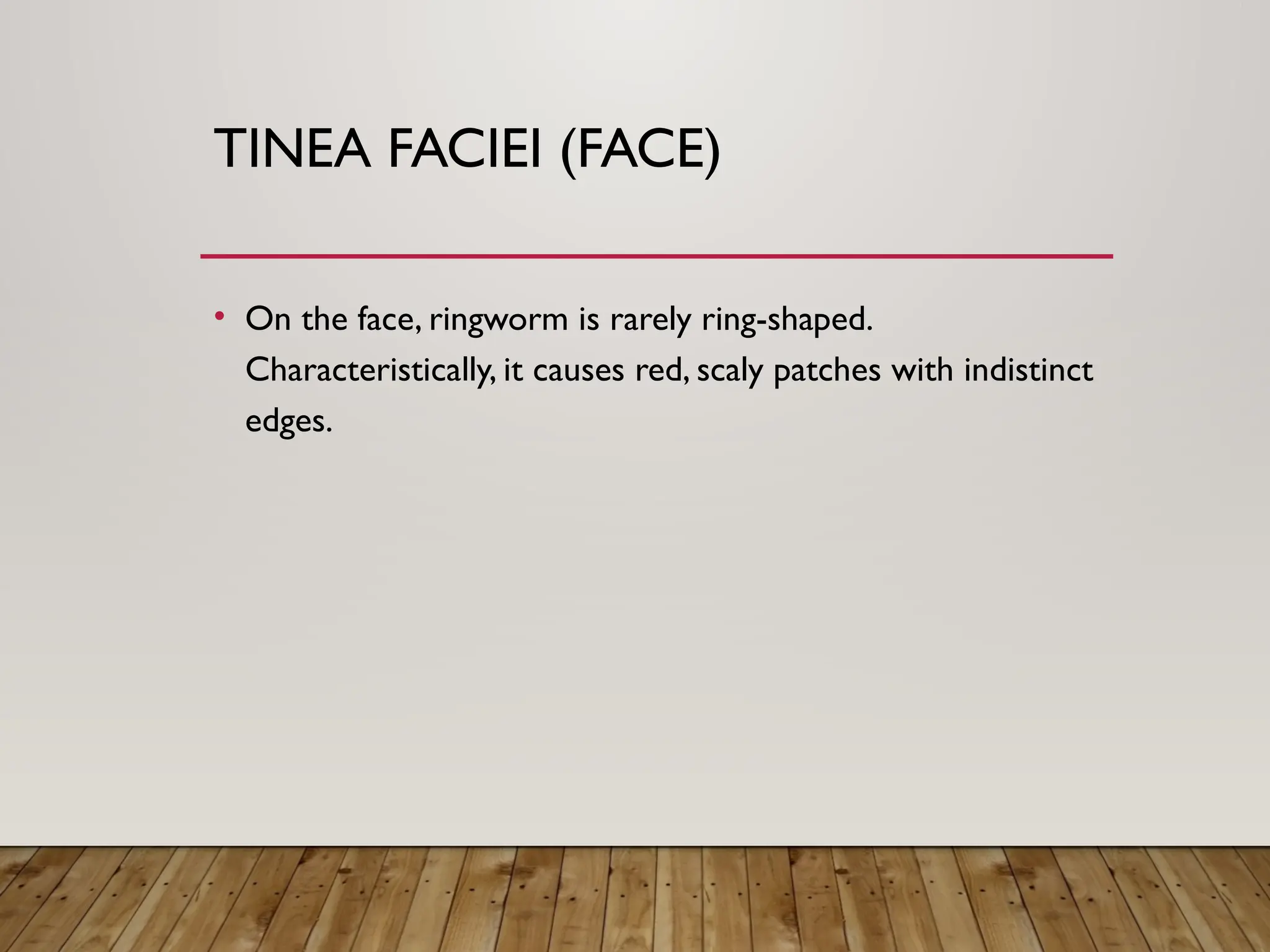 RingWorm Ringworm is a common fungal infection also known as Tinea | PPTX