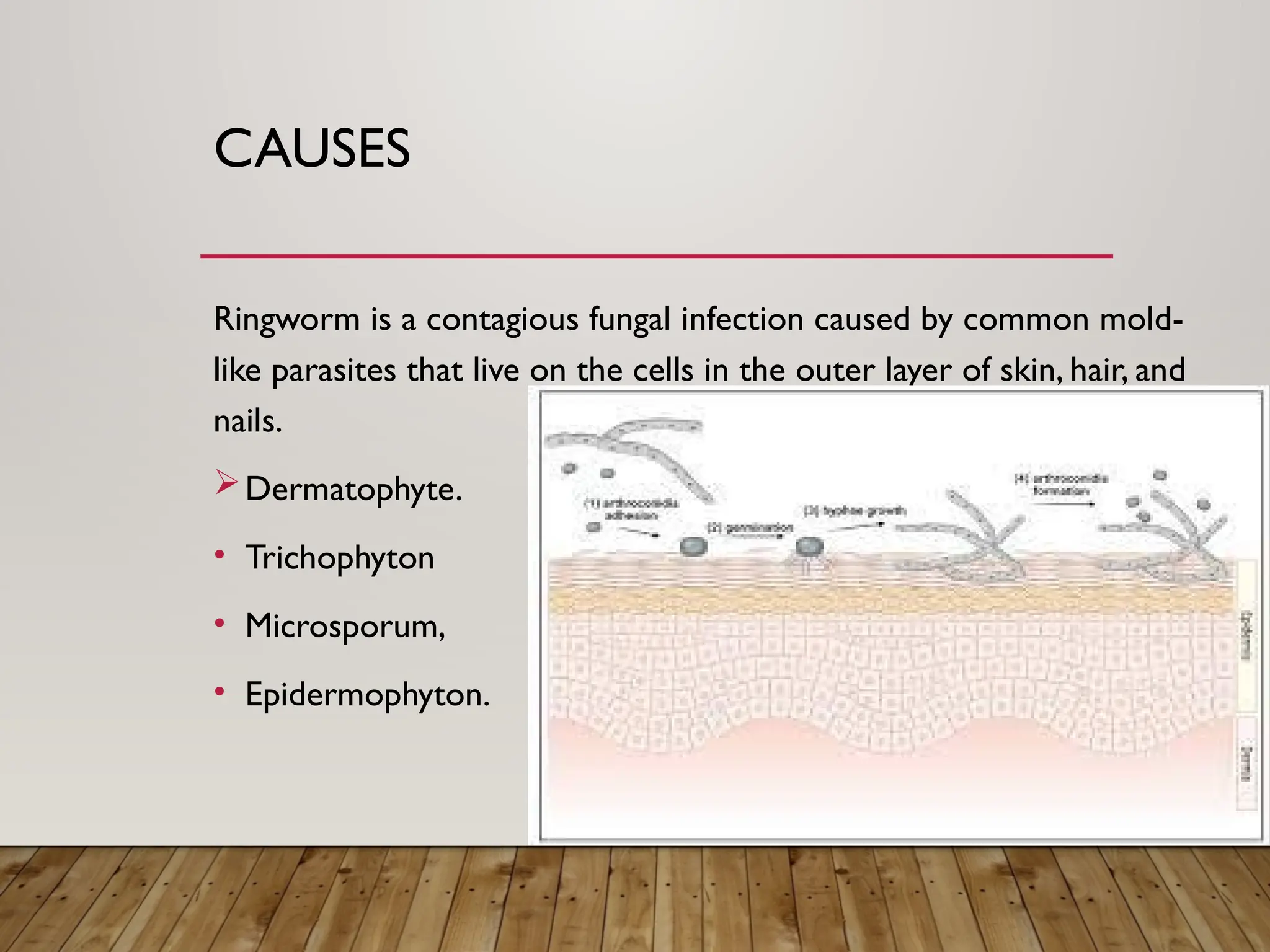 RingWorm Ringworm is a common fungal infection also known as Tinea | PPTX