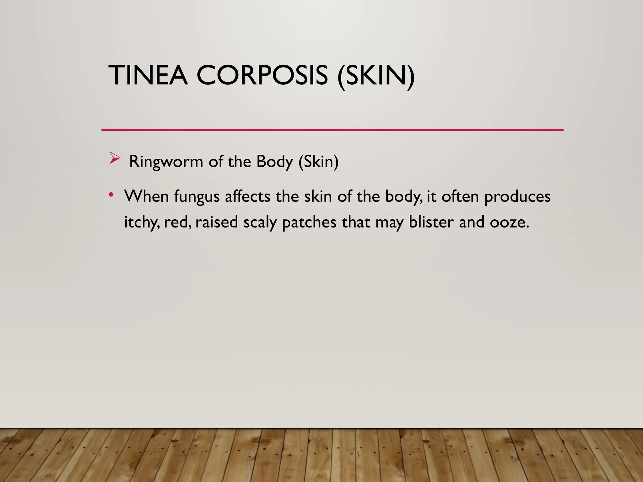 RingWorm Ringworm is a common fungal infection also known as Tinea | PPTX