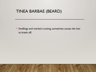 RingWorm Ringworm is a common fungal infection also known as Tinea | PPTX