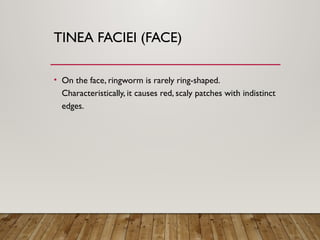 RingWorm Ringworm is a common fungal infection also known as Tinea | PPTX