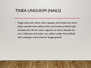 RingWorm Ringworm is a common fungal infection also known as Tinea | PPTX