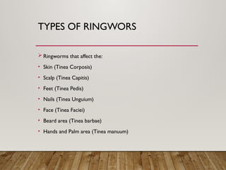RingWorm Ringworm is a common fungal infection also known as Tinea | PPTX