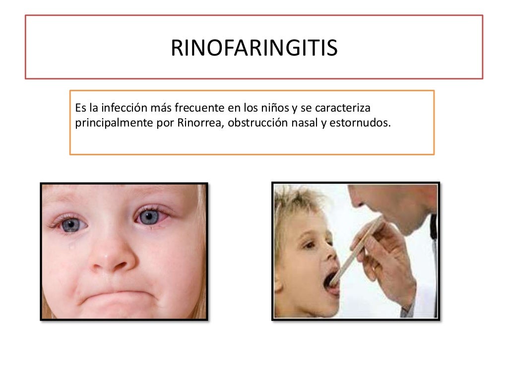 O Que é Rinofaringite - RETOEDU