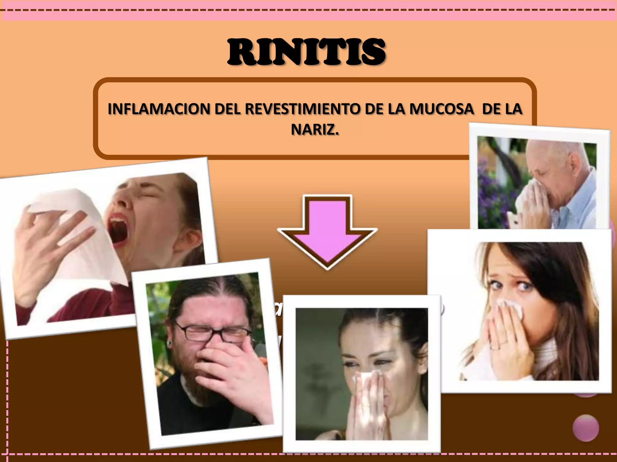 Rinitis alergica | PPTX