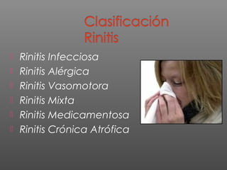 Rinitis Alergica | PPT