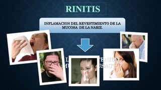 Rinitis alergica | PPTX