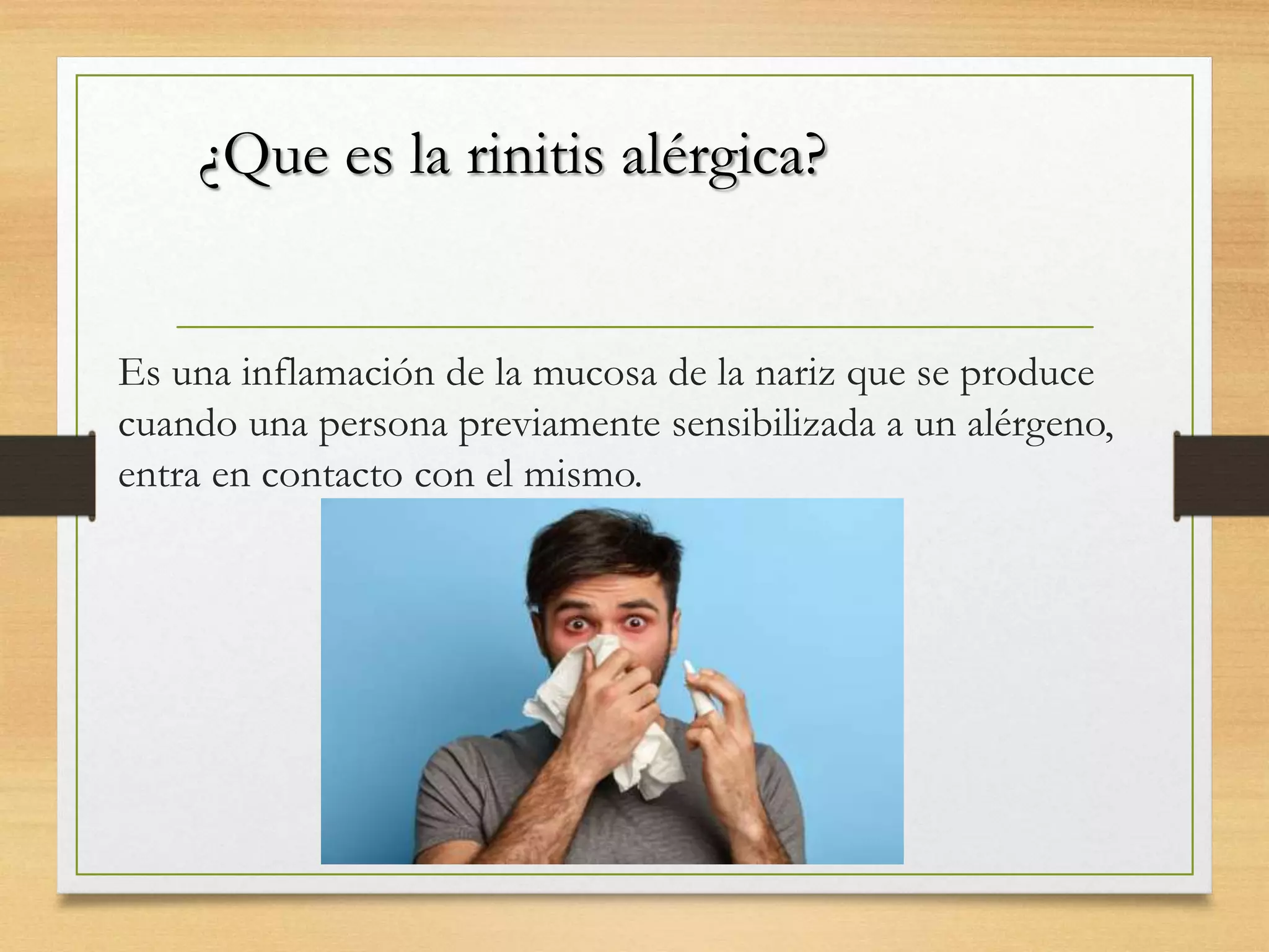 RINITIS ALERGICA.pptx