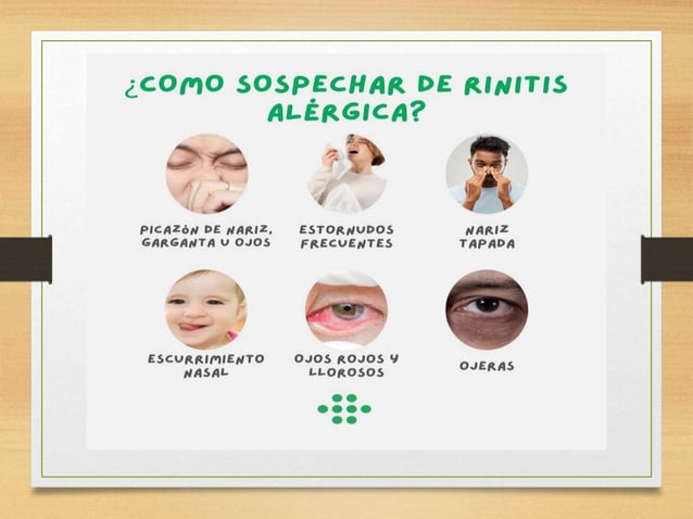 RINITIS ALERGICA.pptx