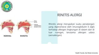 Rinitis Alergik farmasi praktis II.pptmmx | PPTX