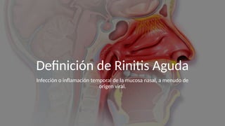 RINITIS ORL.pptx......................... | PPTX