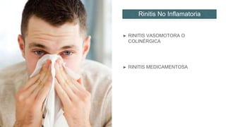 Rinitis y sinusitis | PPTX