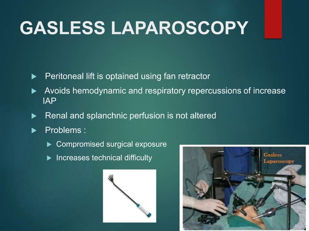 anaesthesia in laparoscopic surgery | PPT