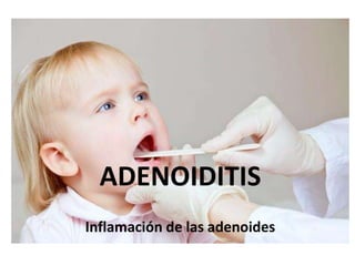 Rinofaringitis y Adenoiditis en Pediatria | PPTX