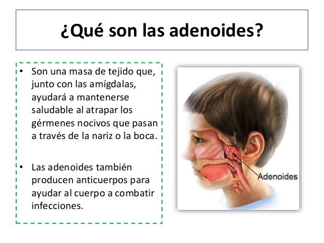Rinofaringitis y Adenoiditis en Pediatria