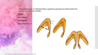 Rinoplastia abierta y cerrada 2 | PPTX