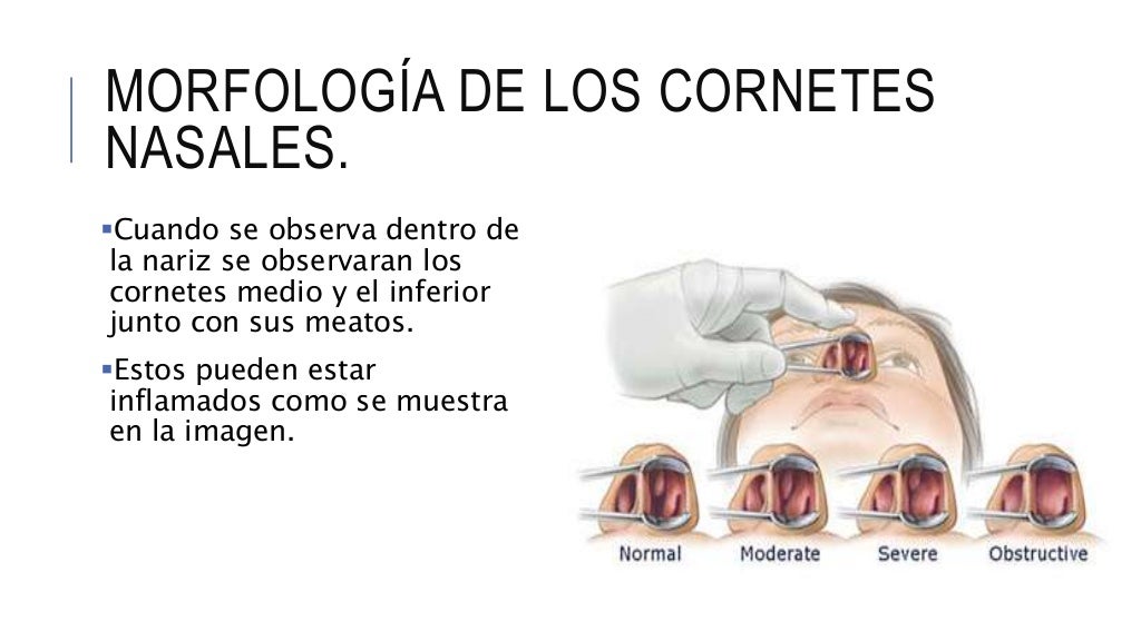 Rinoscopia anterior y posterior