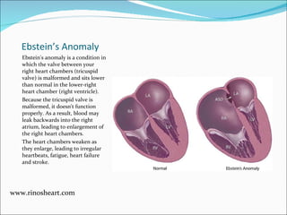 Rino’s heart | PPT
