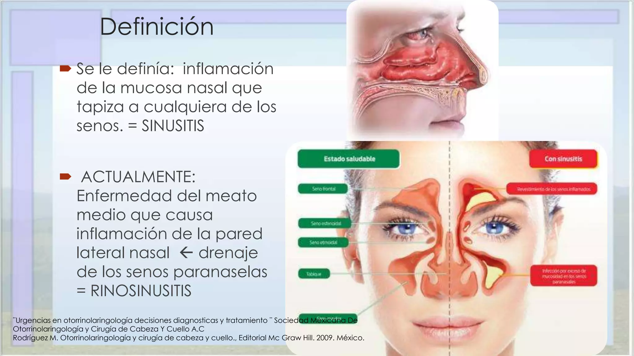 Rinosinusitis aguda y cronica