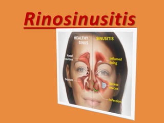 Rinosinusitis definitivo | PPT
