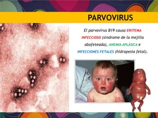 Rinovirus, Parvovirus & Poliovirus | PPTX