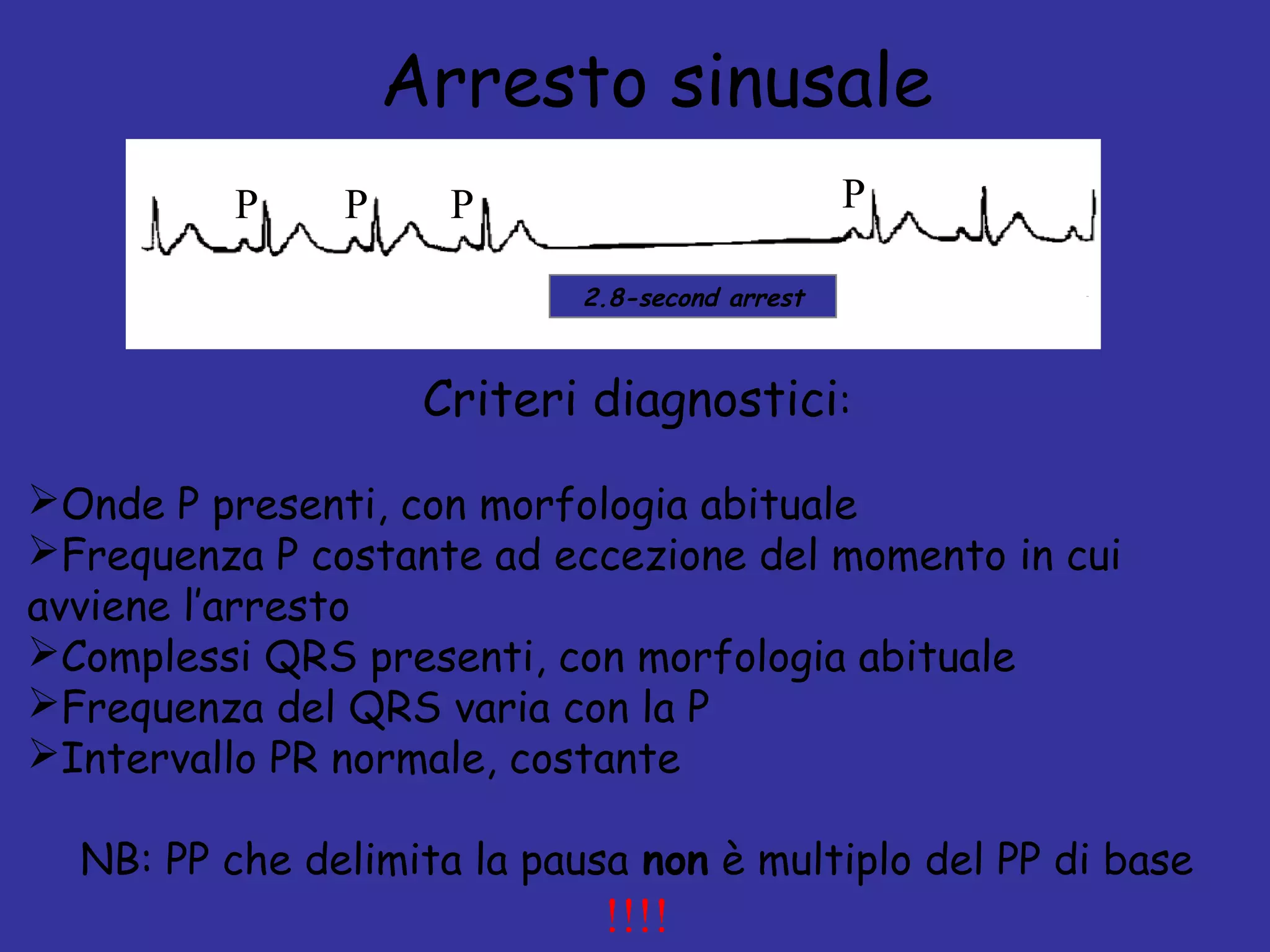 Ripetizioni di elettrocardiografia | PPT